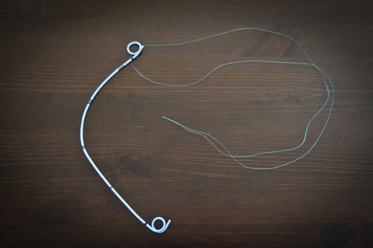 How is a Ureteral Stent Removed? - Kidney Stone Collaborative