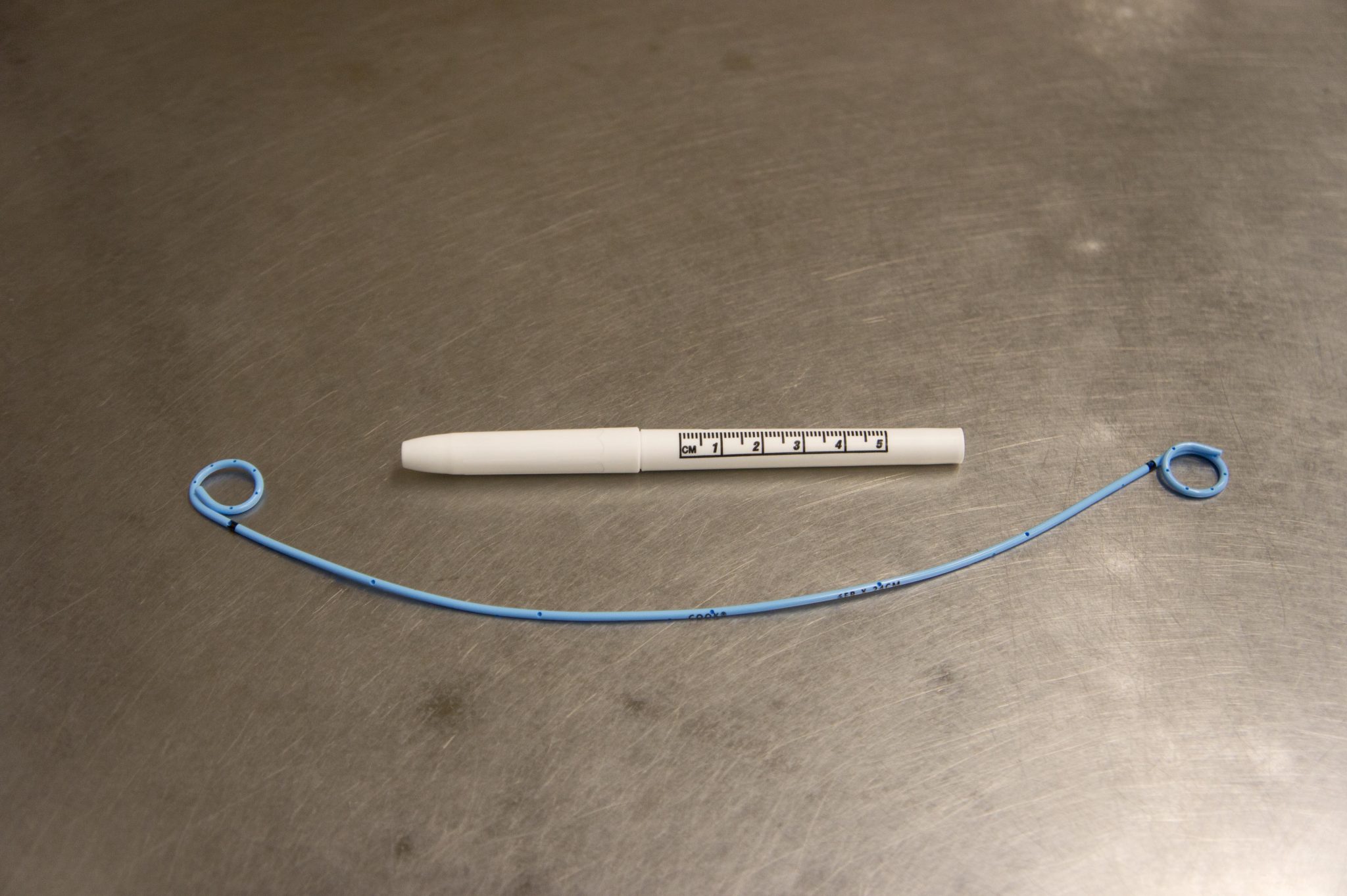 How is a Ureteral Stent Removed? What to Expect